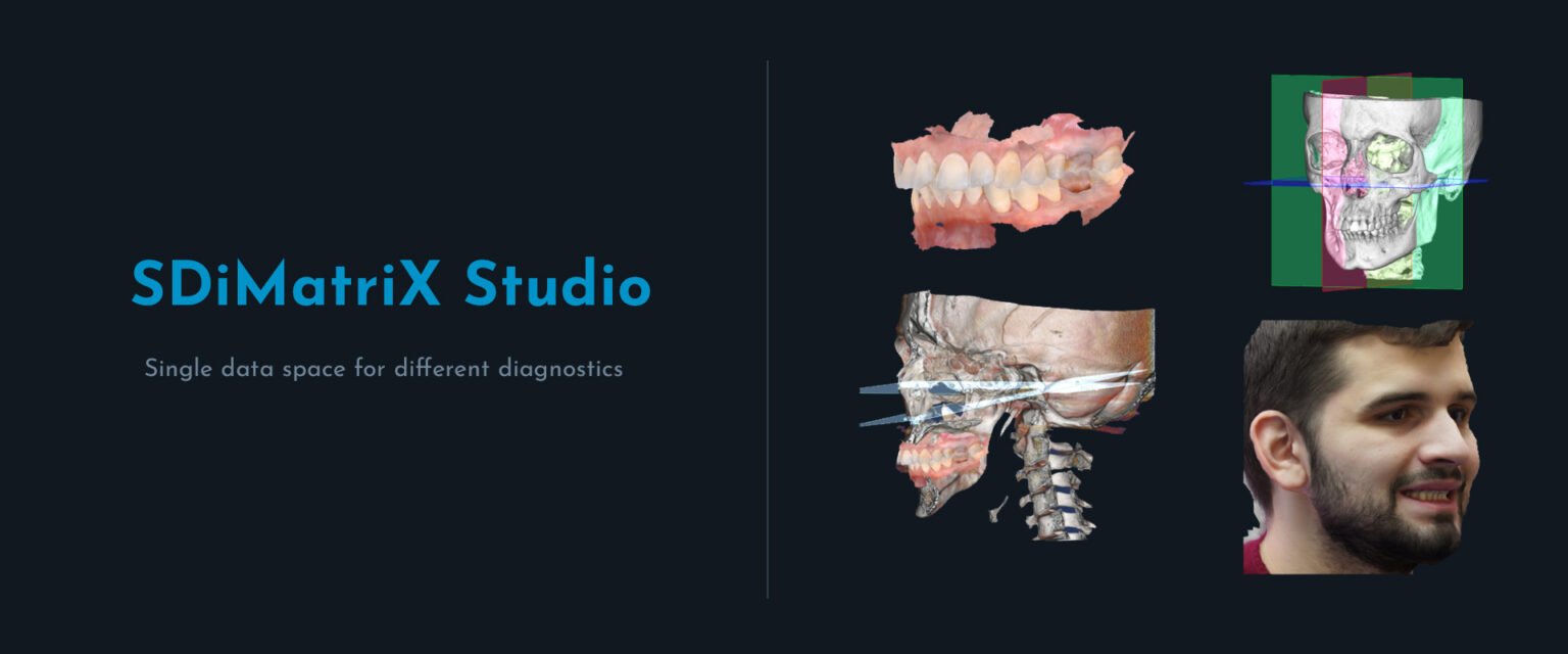 SDI Matrix – Villa India